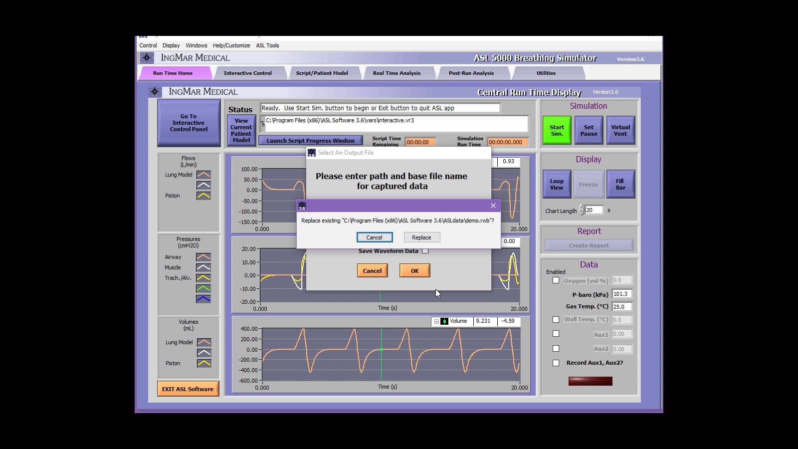 ASL 5000 Software 3.6 - Saving Patient Models with the Interactive ...