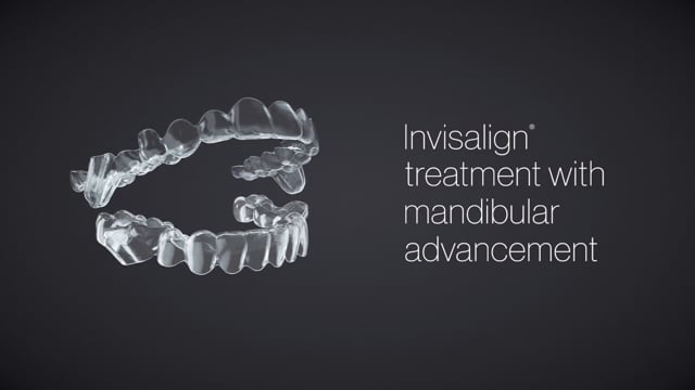 Invisalign on Vimeo