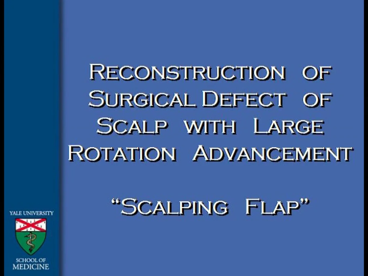Dr Stephan Ariyan - RECONSTRUCTION OF SURGICAL DEFECT OF SCALP WITH ...