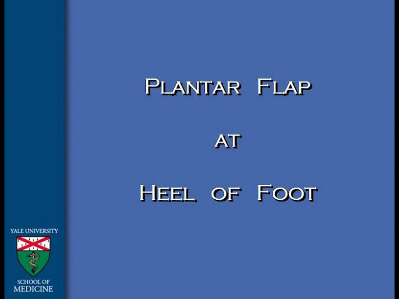 Dr. Stephan Ariyan- PLANTAR FLAP AT HEEL OF FOOT on Vimeo