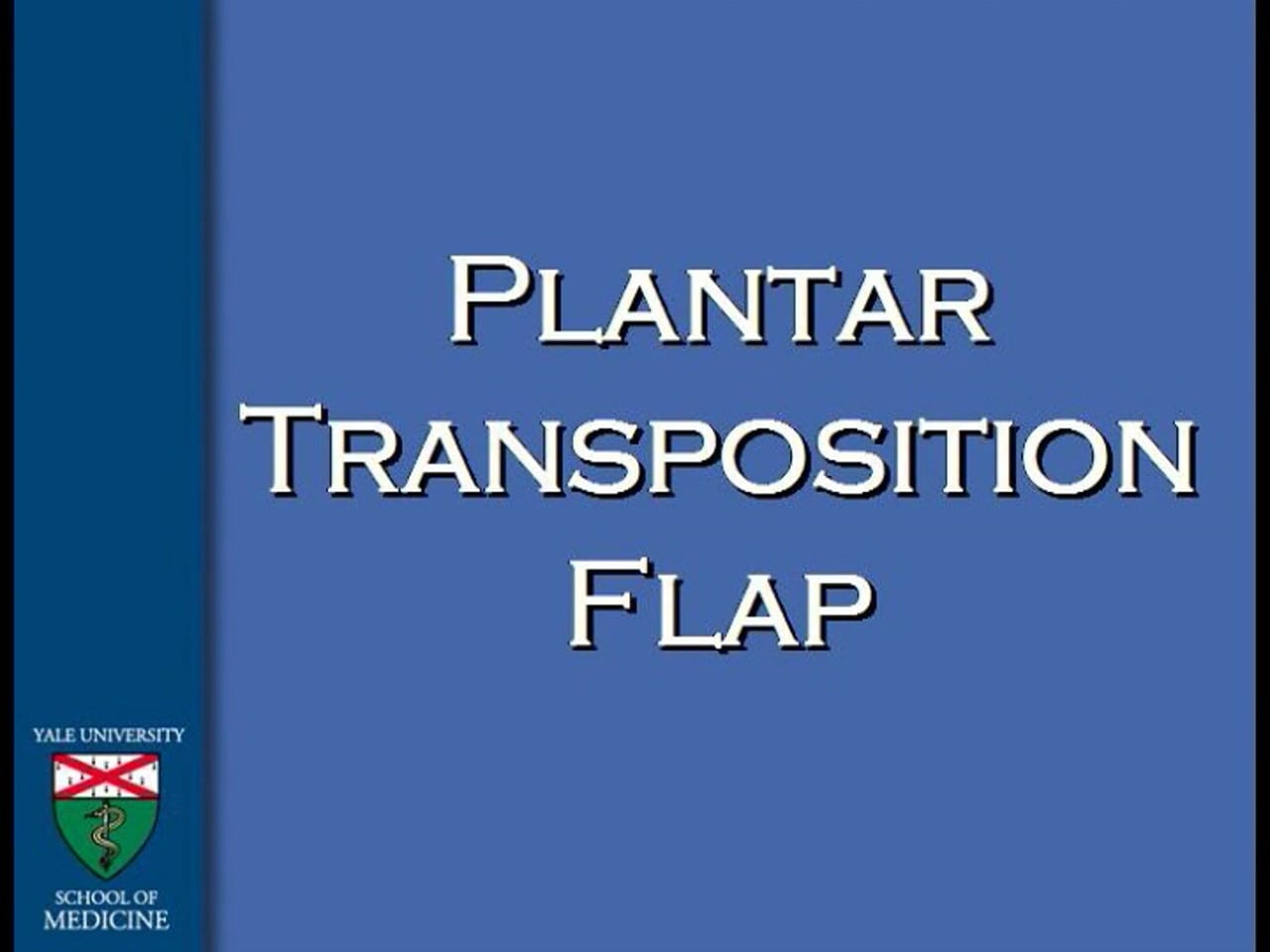 Transposition Flap