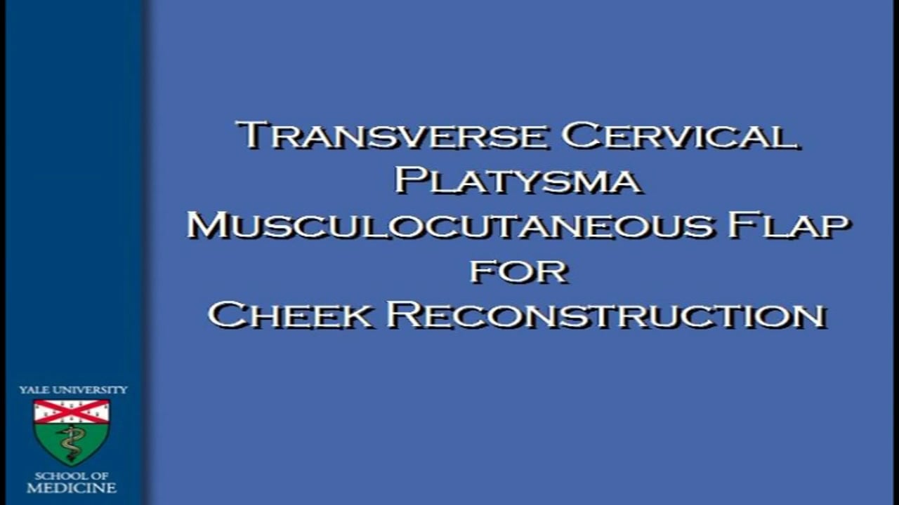 OPERATIVE PROCEDURES - Dr Stephan Ariyan - TRANSVERSE CERVICAL PLATYSMA ...