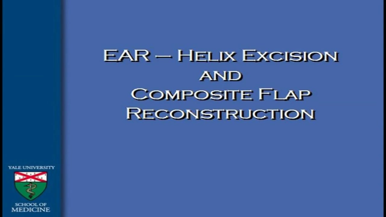 OPERATIVE PROCEDURES - Dr Stephan Ariyan - EAR HELIX EXCISION AND ...