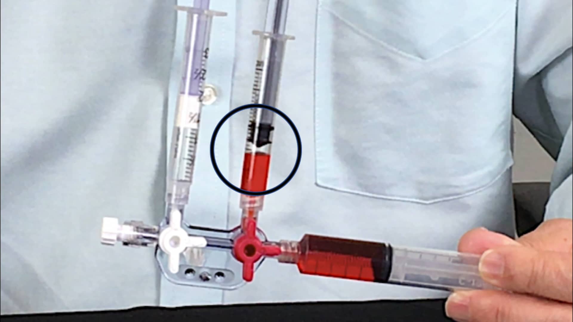 ABG Draw with Pulset Syringe on Manifold on Vimeo