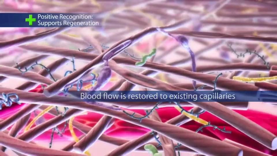 AlloDerm® Regenerative Tissue Matrix Animation on Vimeo