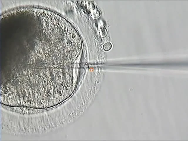 Equine ICSI on Vimeo