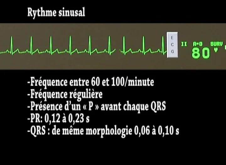 Rythme sinusal on Vimeo