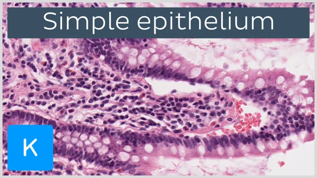 Simple Columnar Epithelium Labeled