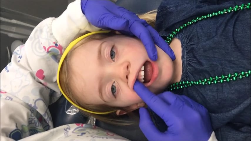 Toddler exercises after frenectomy on Vimeo