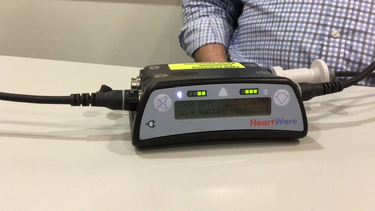 Demonstration of a controller changeout for the Heartware (HVAD) Left ...