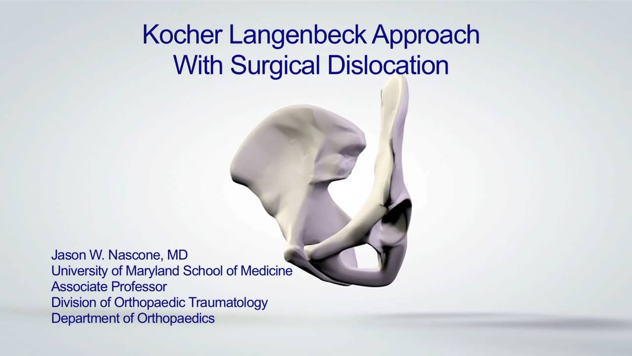 Kocher Langenbeck Approach on Vimeo