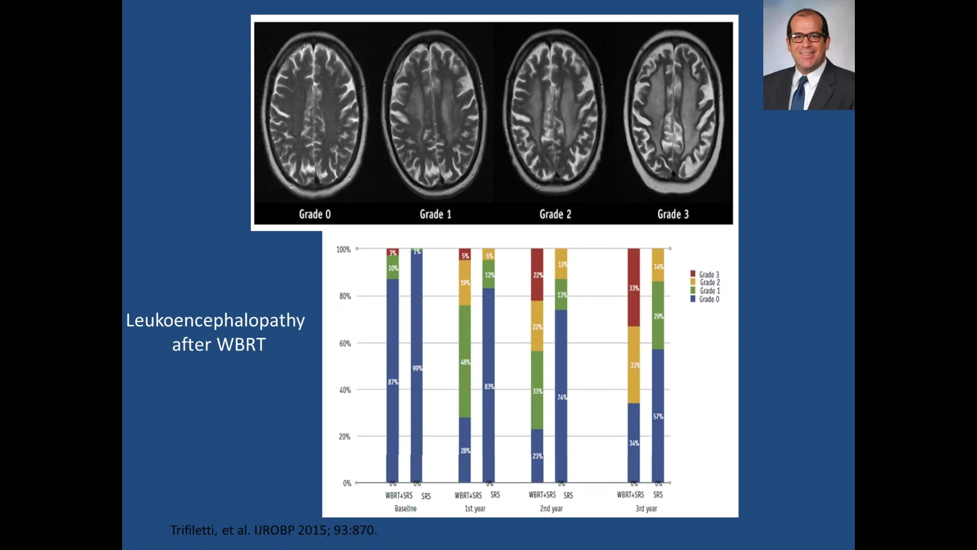 2018 March ASTRO-ARRO Residents CNS Webinar on Vimeo
