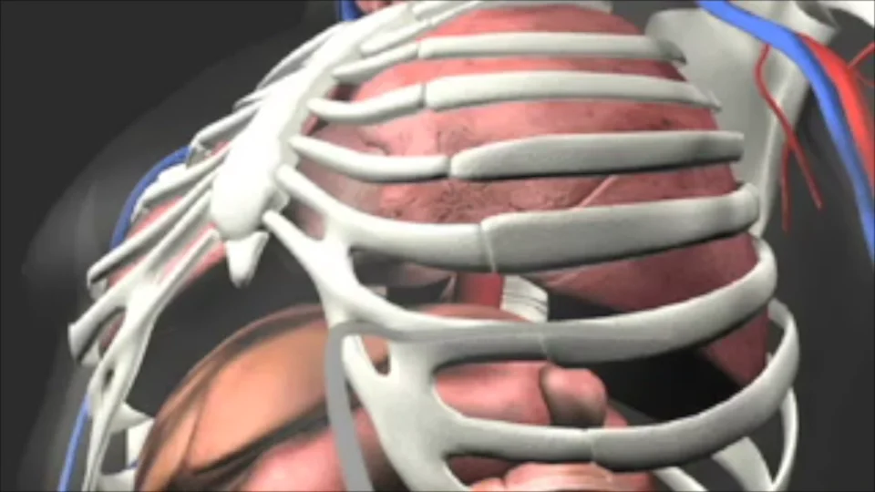 Aspira Pleural Drainage Catheter Procedure on Vimeo