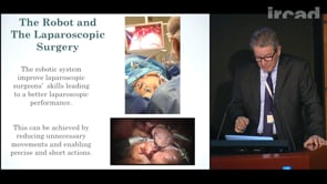 Robotic gastric bypass: technique | WebSurg, the online university of IRCAD