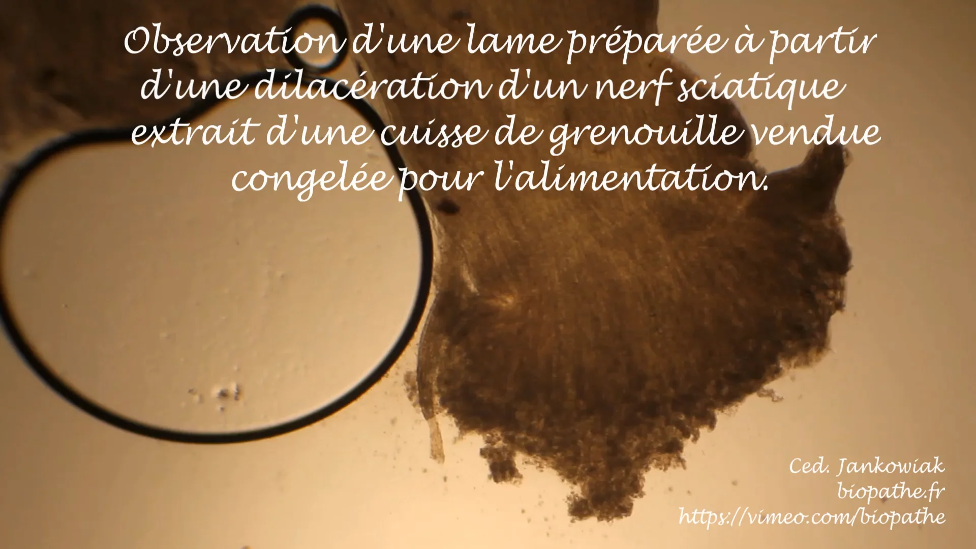 observation microscopique d'une lame de dilacération d'un nerf ...