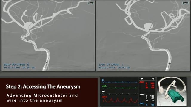 Angio Mentor - Simulateur de Chirurgie Endovasculaire - Twin Medical
