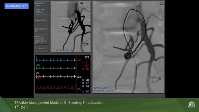 Angio Mentor - Simulateur de Chirurgie Endovasculaire - Twin Medical
