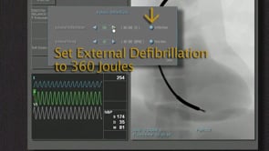 Angio Mentor - Simulateur de Chirurgie Endovasculaire - Twin Medical