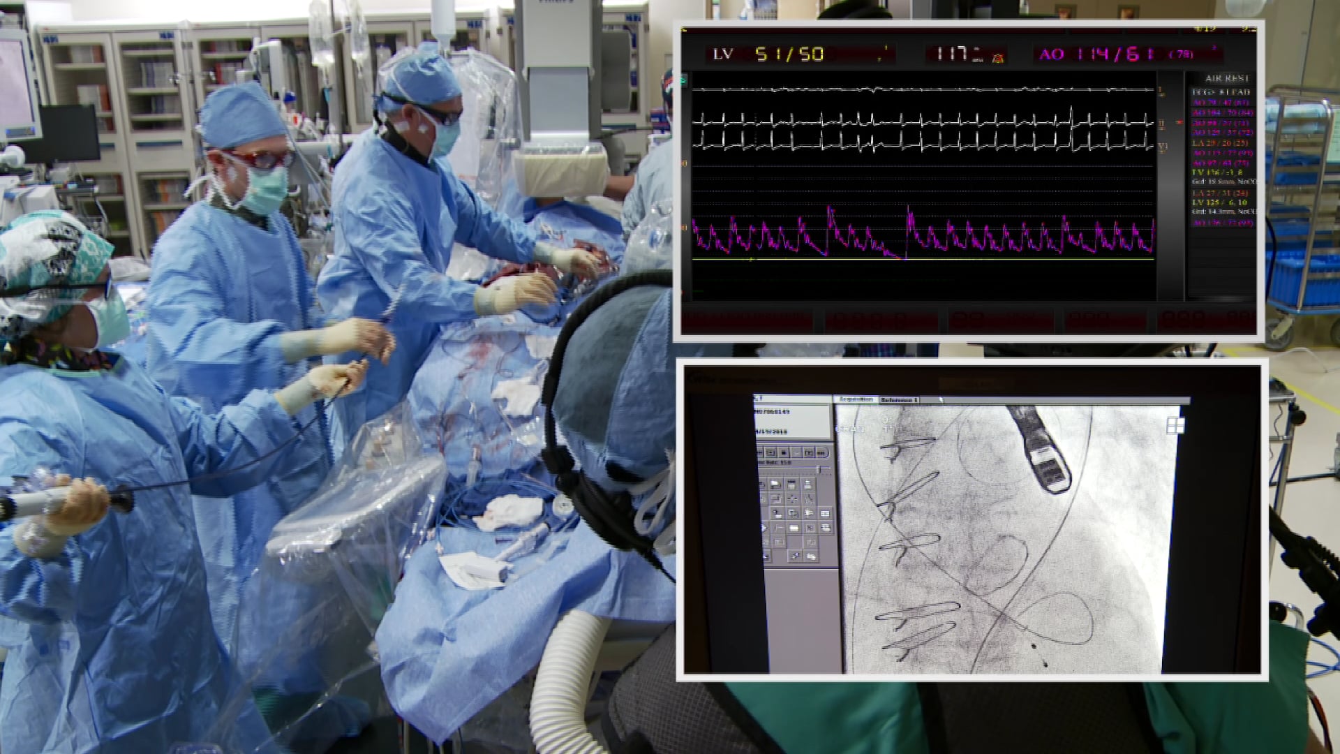 Live Procedure Clip - Surgery on Vimeo