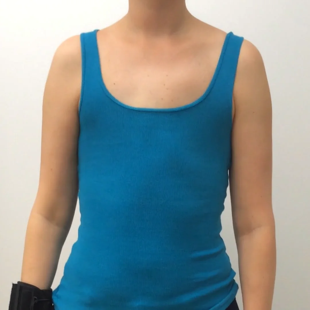 Custom Made Prostheses After a Double Mastectomy on Vimeo