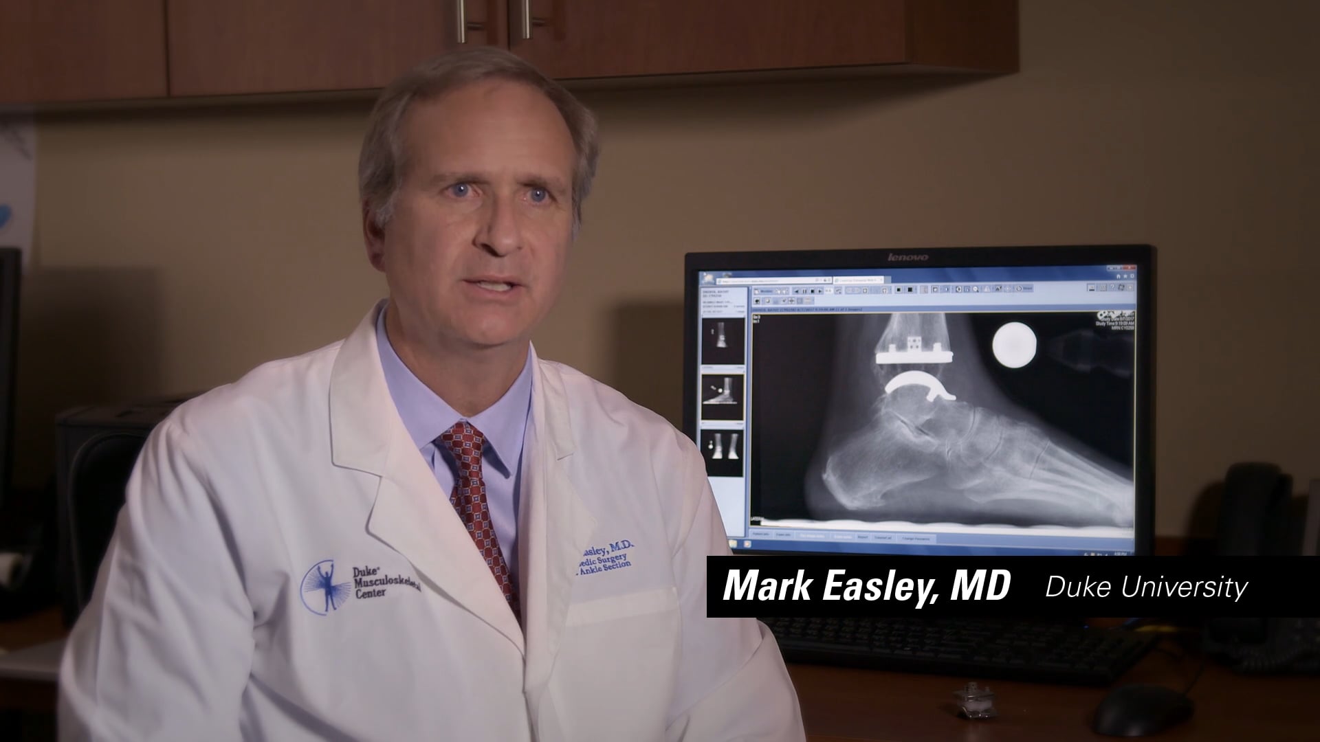 Why I choose Vantage Ankle - Mark Easley, MD on Vimeo