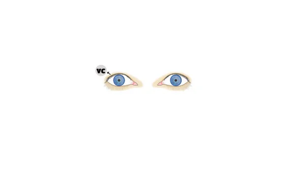 NLP Eyes on Vimeo