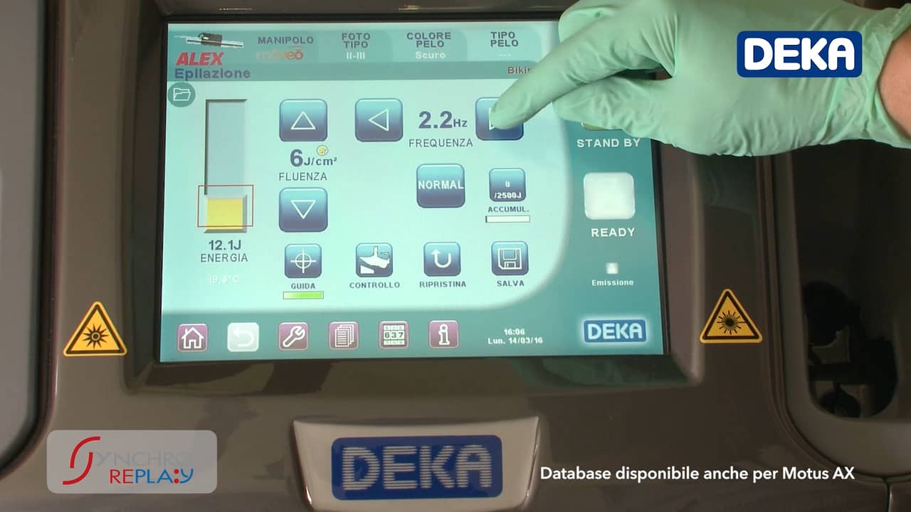 Лазерная эпиляция бикини аппаратом Deka Motus AX Moveo on Vimeo