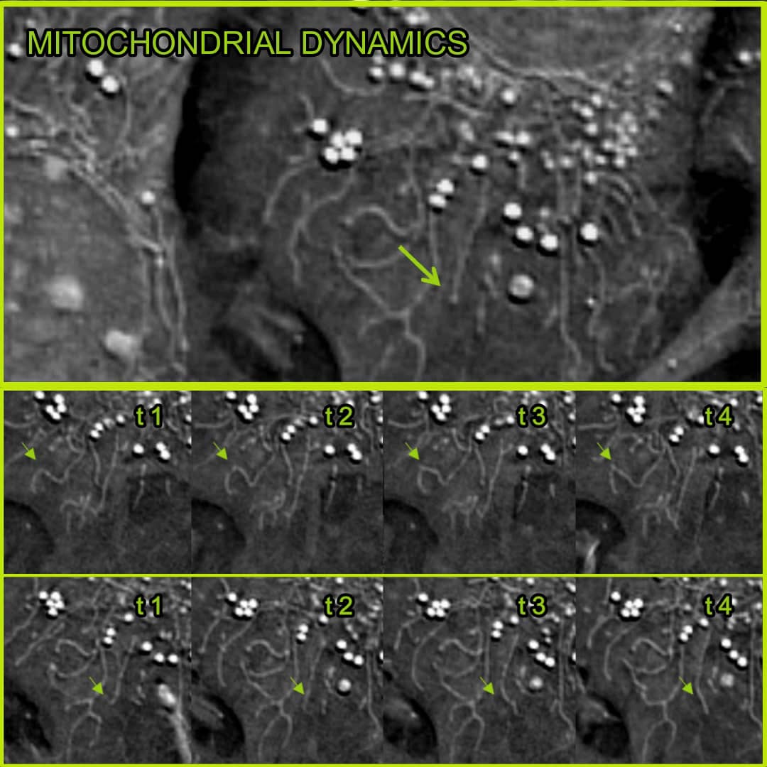3D label-free Live Cell Imaging: Mitochondria Fission & Fusion on Vimeo