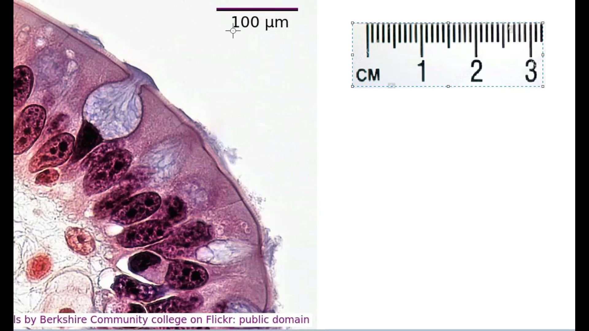 Calculating cell size using a scale bar on Vimeo
