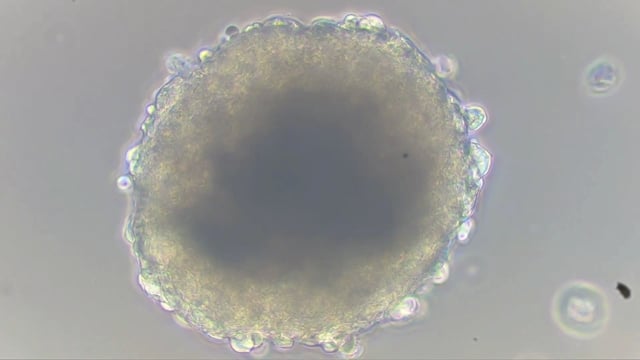 Cardiomiócitos Coração Cultura De - Free video on Pixabay