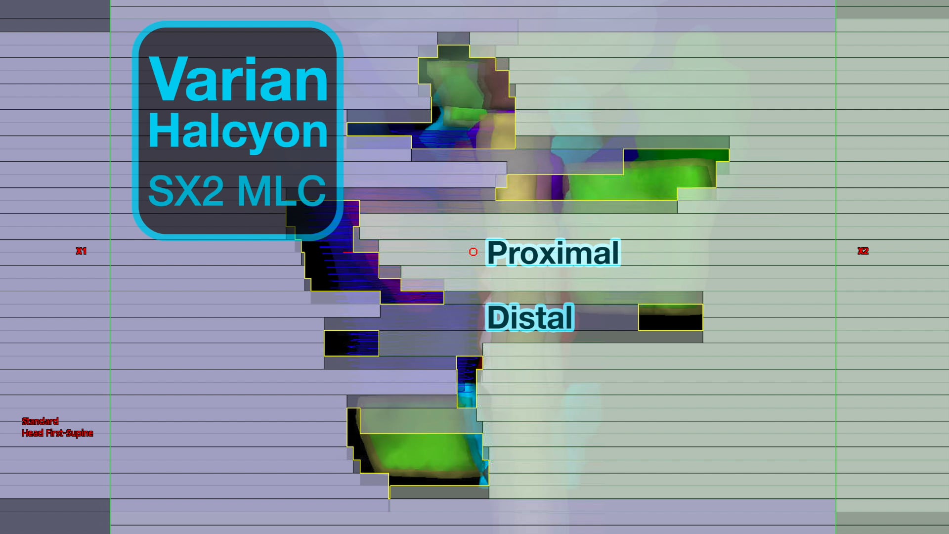 UC San Diego - Varian Halcyon SX2 MLC on Vimeo