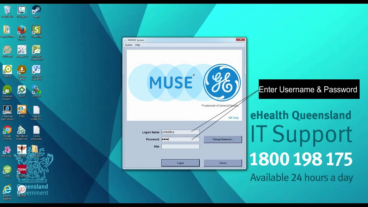 MUSE - How to Send an ECG
