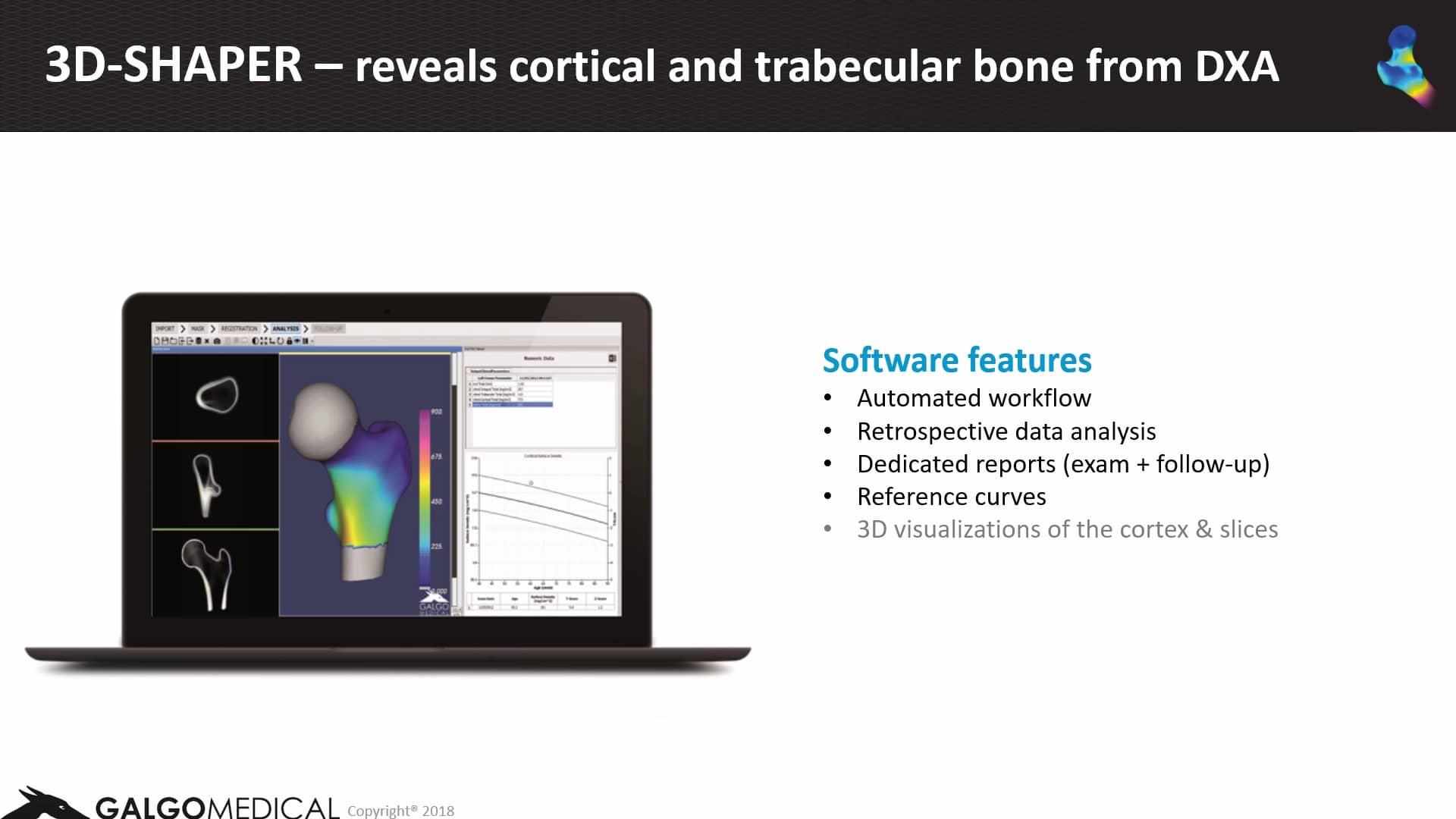 3D-SHAPER Software Introduction on Vimeo
