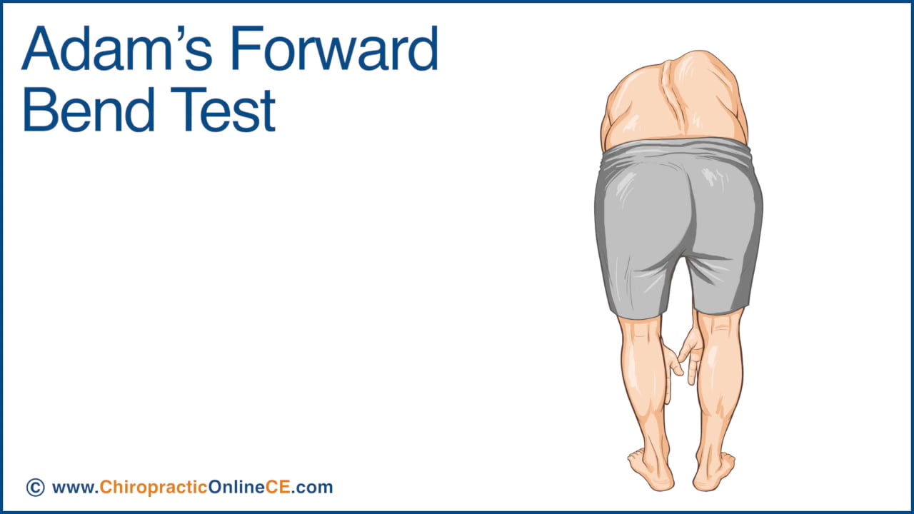 US-Adam's-Forward-Bend Test Video-2018 on Vimeo