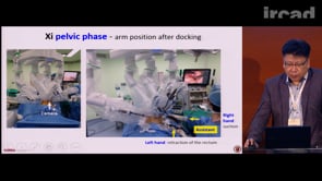Robotic LAR - How to maximize success in difficult surgery | WebSurg ...