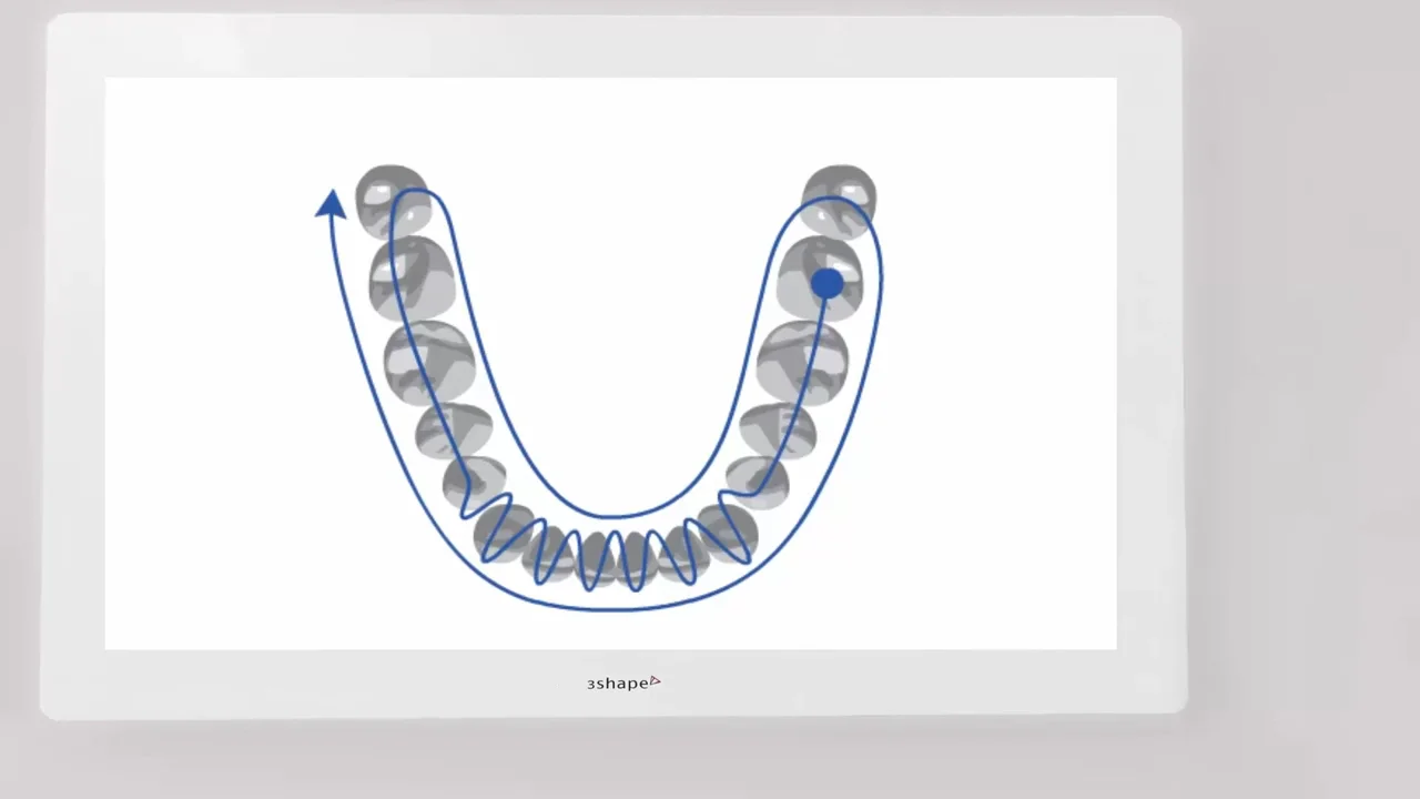 3Shape TRIOS Scan Strategy - Full Arch on Vimeo