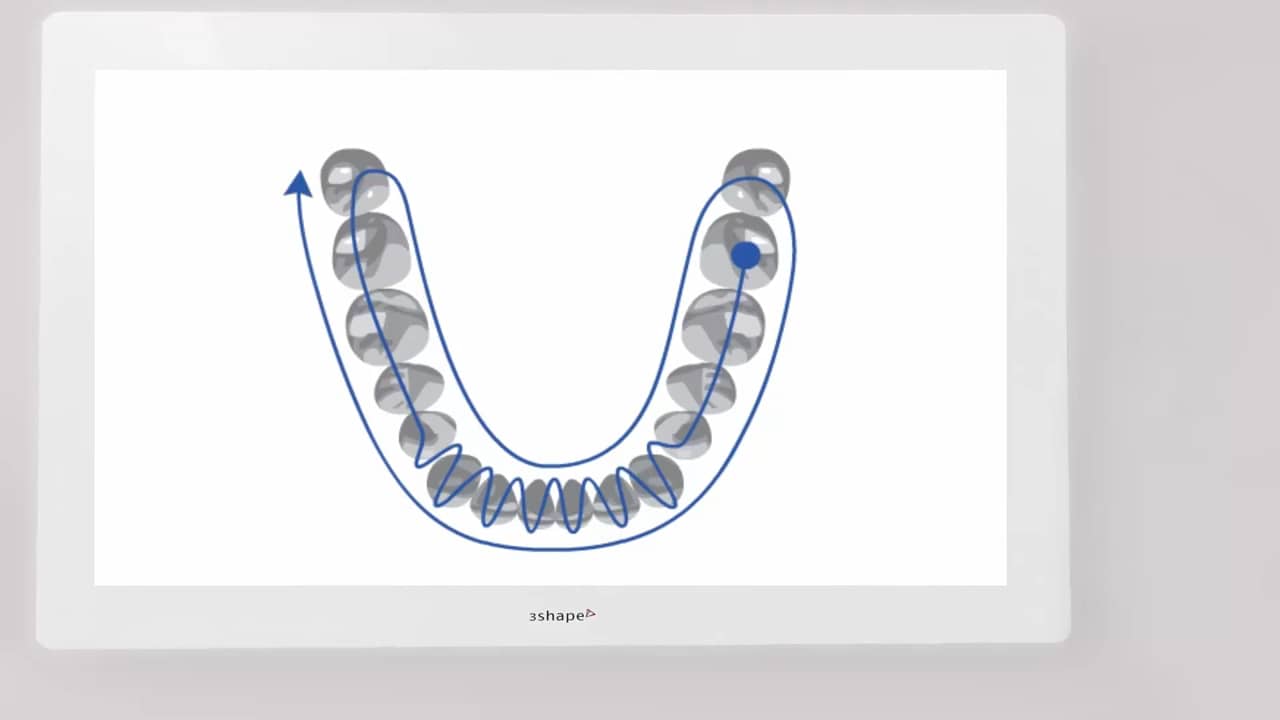 3Shape TRIOS Scan Strategy - Full Arch on Vimeo