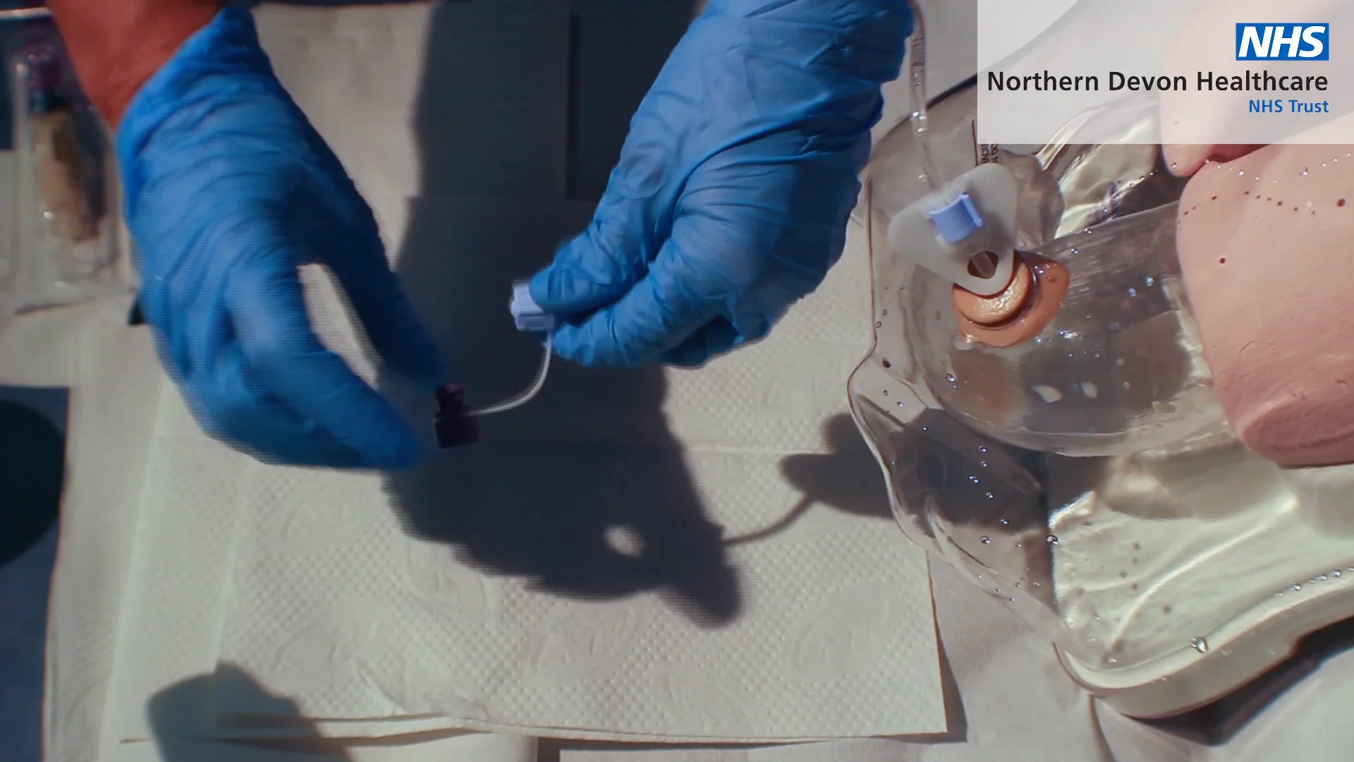 Medication Via A PEG on Vimeo