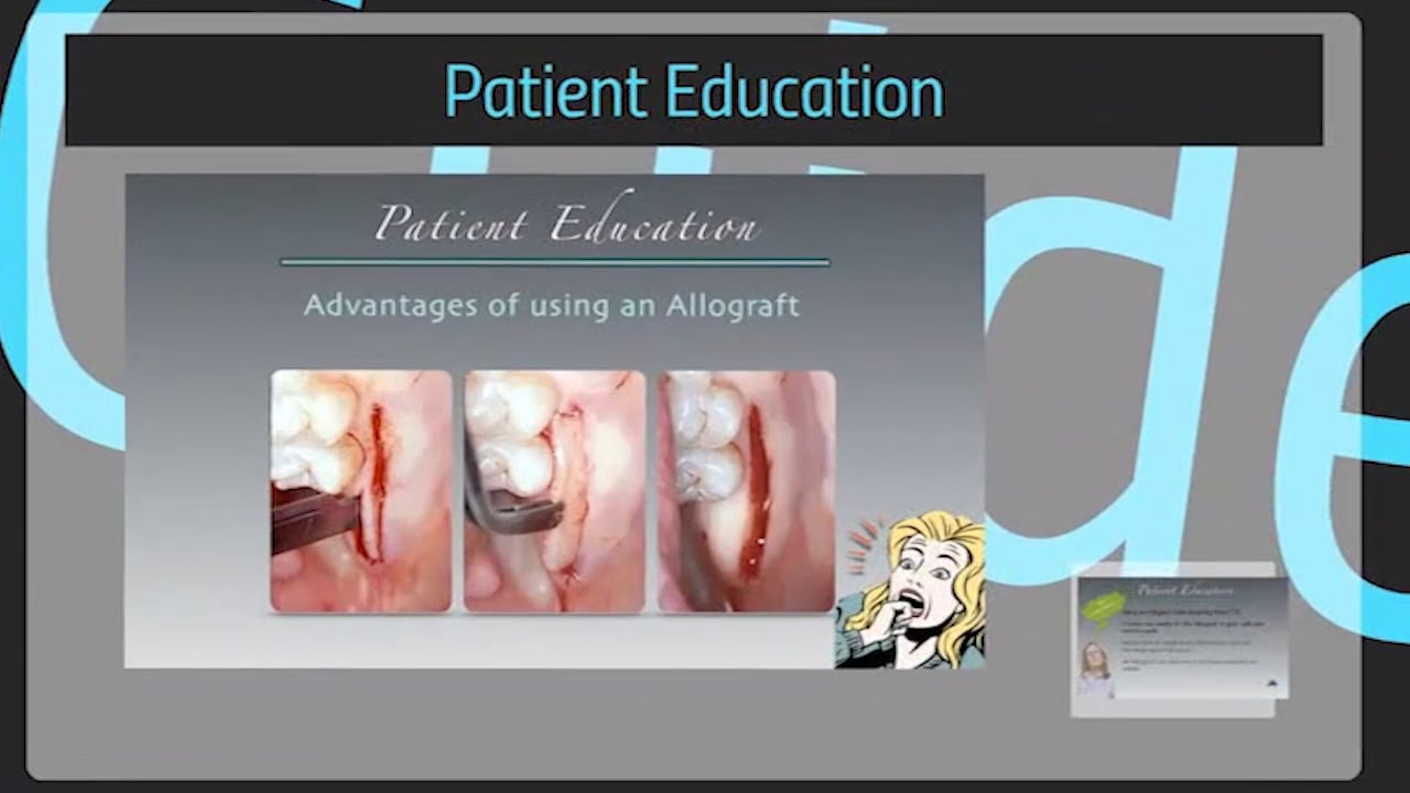 Watch T-1 A Surgical Assistant's Guide to Successful Alloderm Grafting ...