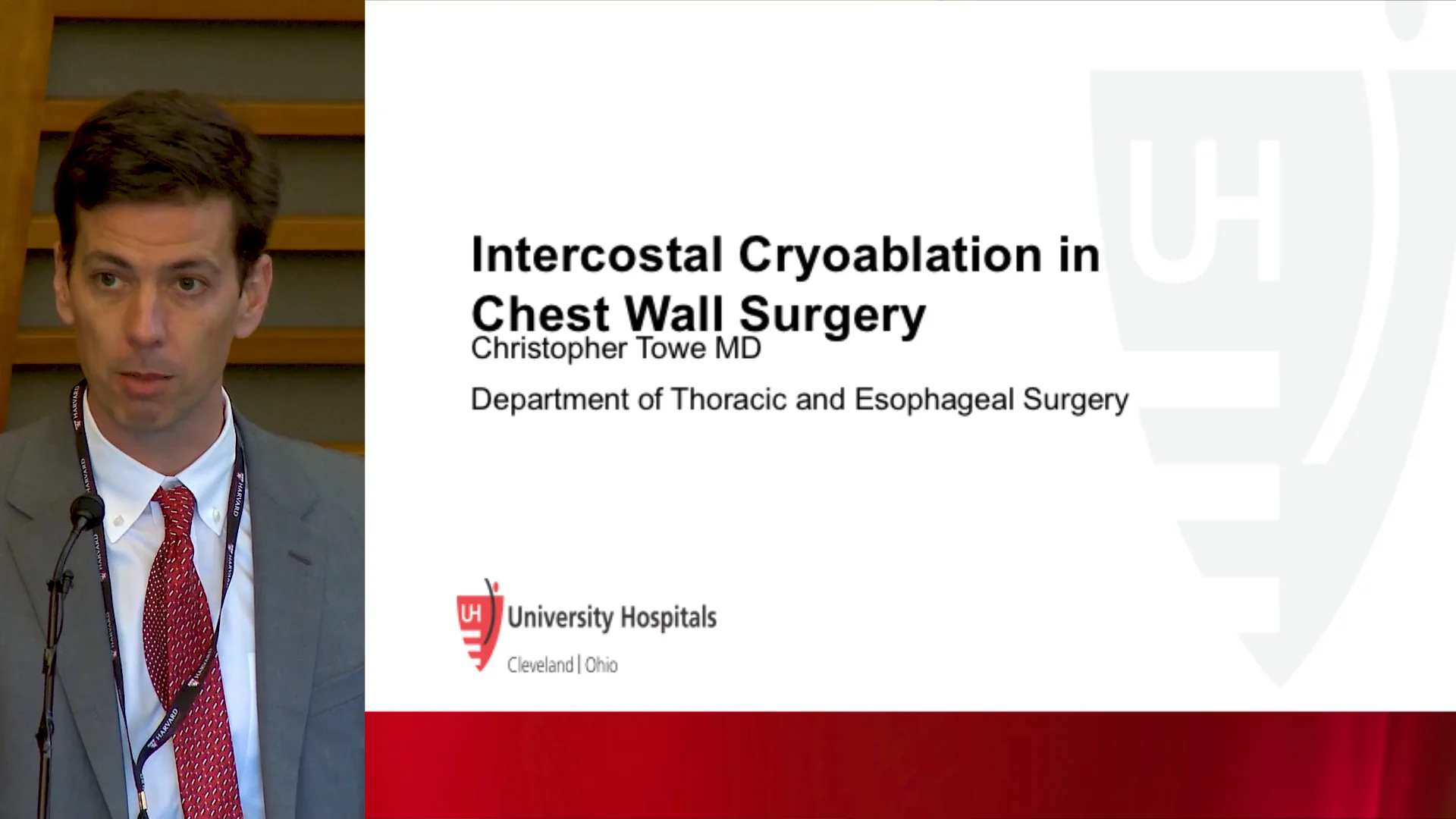 Intercostal Cryoablation in Chest Wall Surgery on Vimeo
