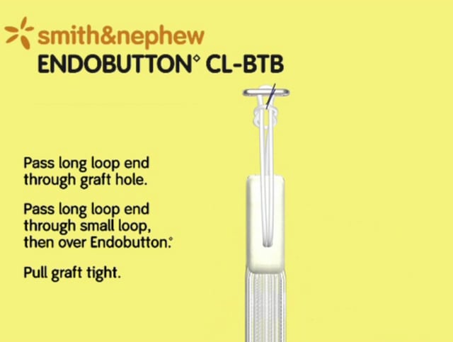 EndoButton BTB Animation on Vimeo