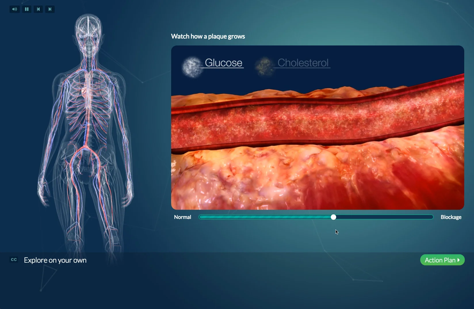 3D Interactive_Diabetic Heart on Vimeo