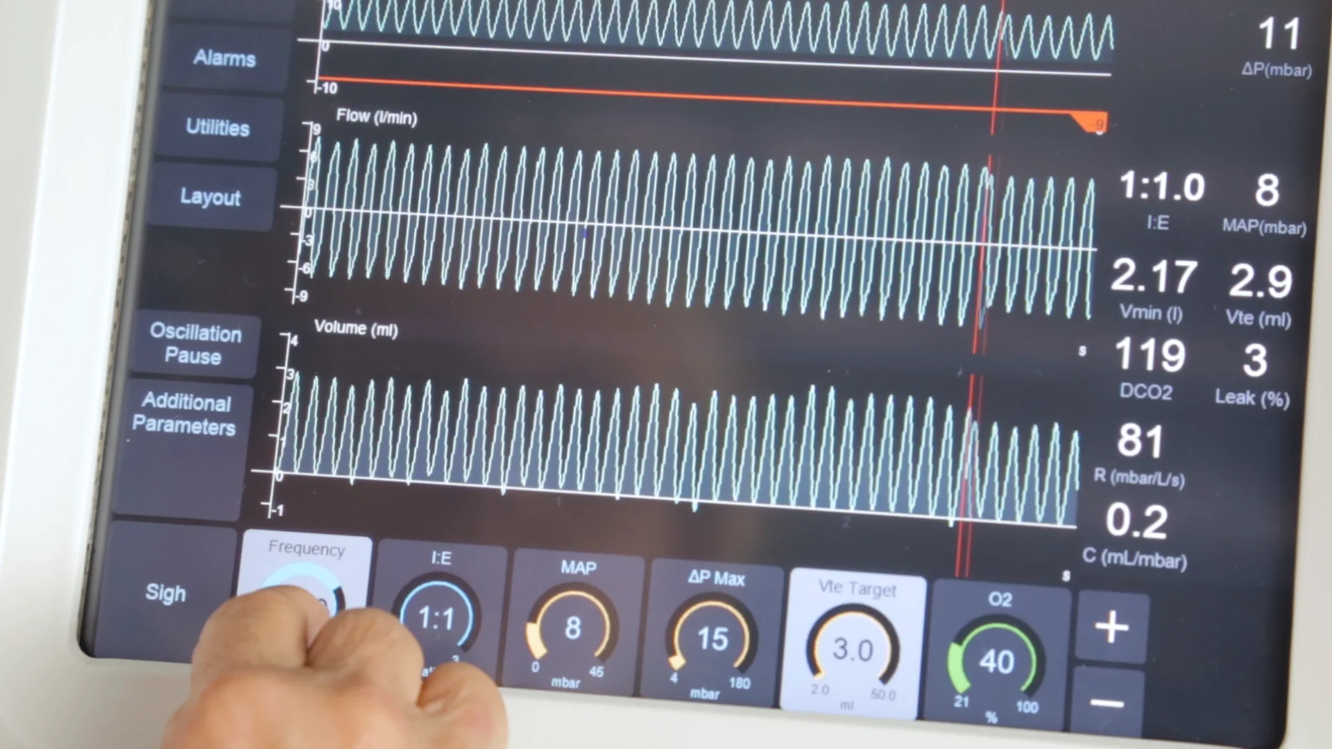 SLE6000 Ventilator Promotional Video