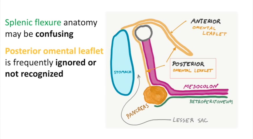 Splenic Flexure Anatomy, Inferior-Medial Approach, Lap Left for ...