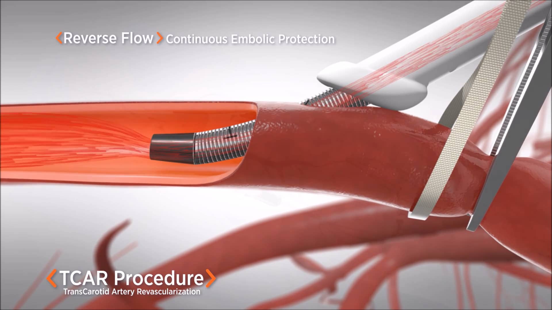 TCAR Animation (Short) on Vimeo