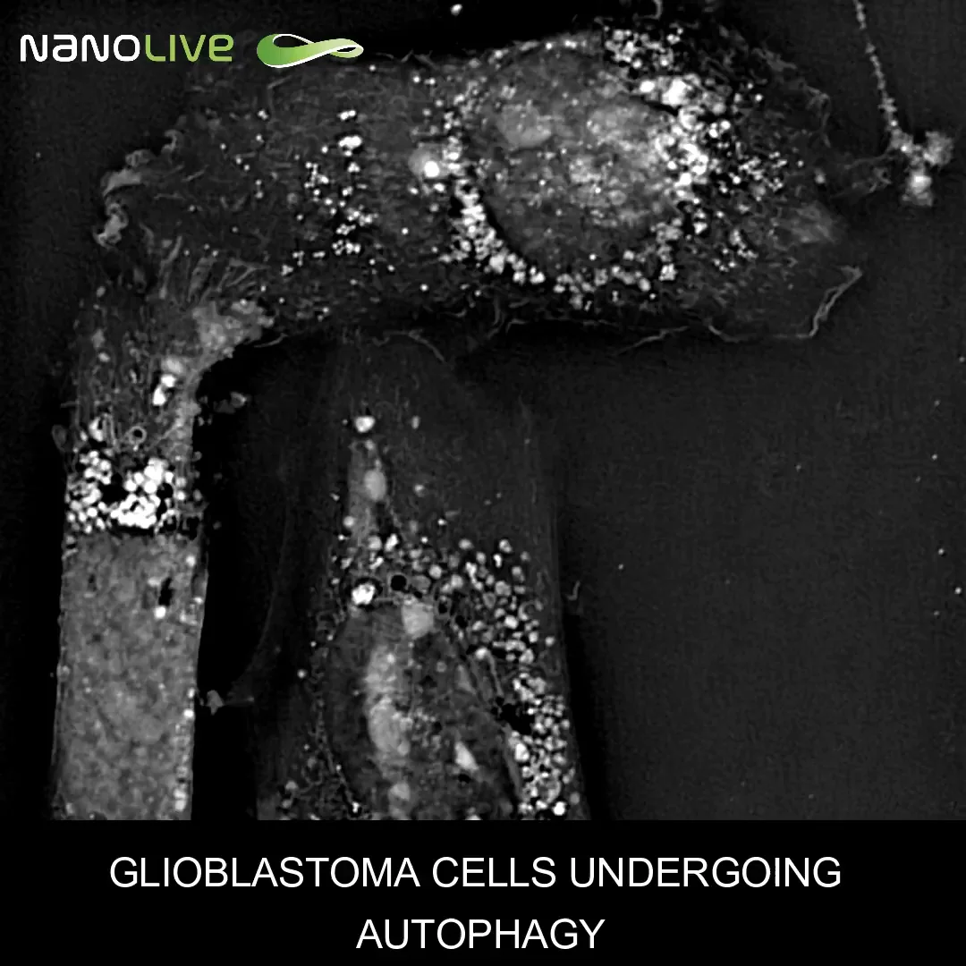 Label-free Live Cell Imaging: Glioblastoma cells undergoing autophagy ...