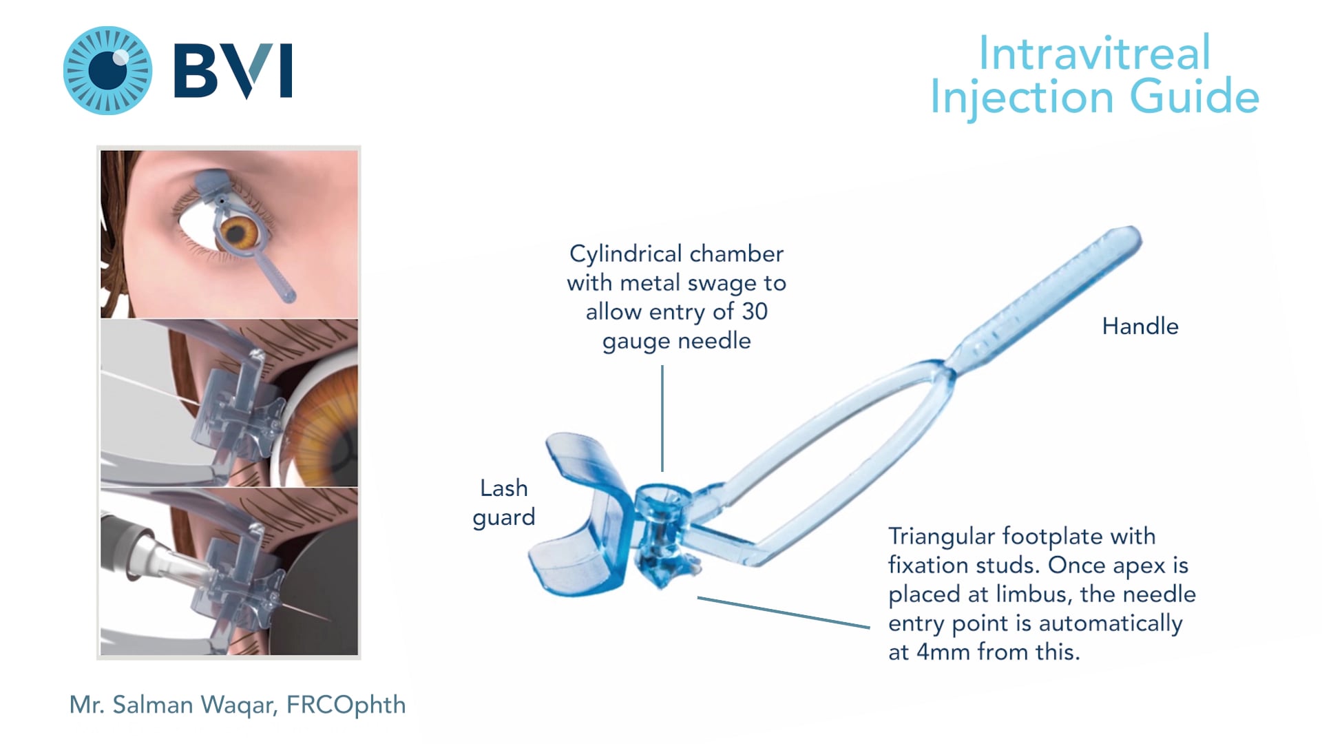 Malosa Intravitreal Injection Guide on Vimeo