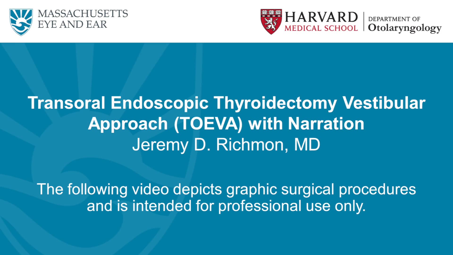 Transoral Endoscopic Thyroidectomy Vestibular Approach (TOEVA) with ...
