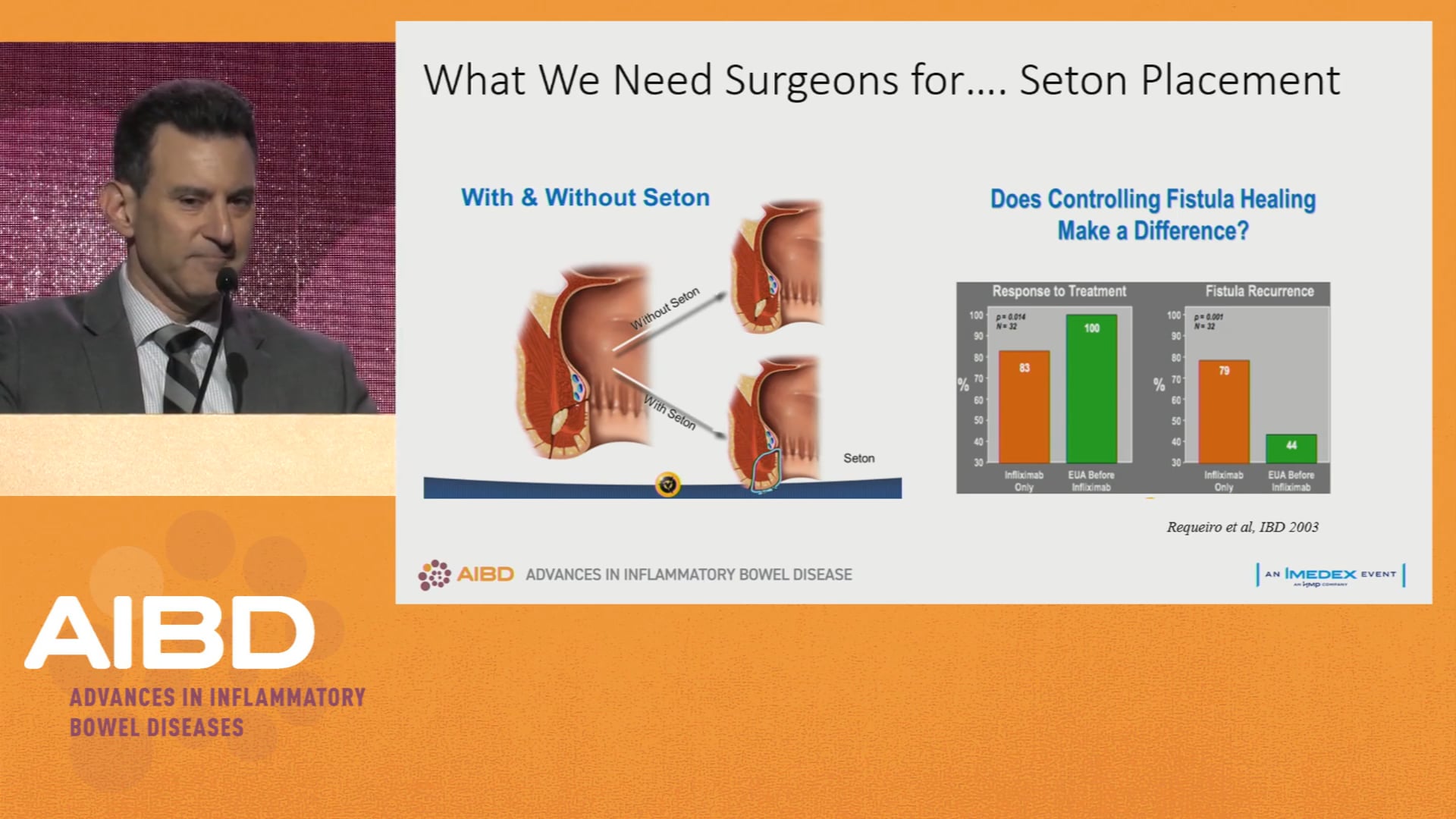 Debate 1: Crohn's disease patient with a vaginal fistula, three months ...