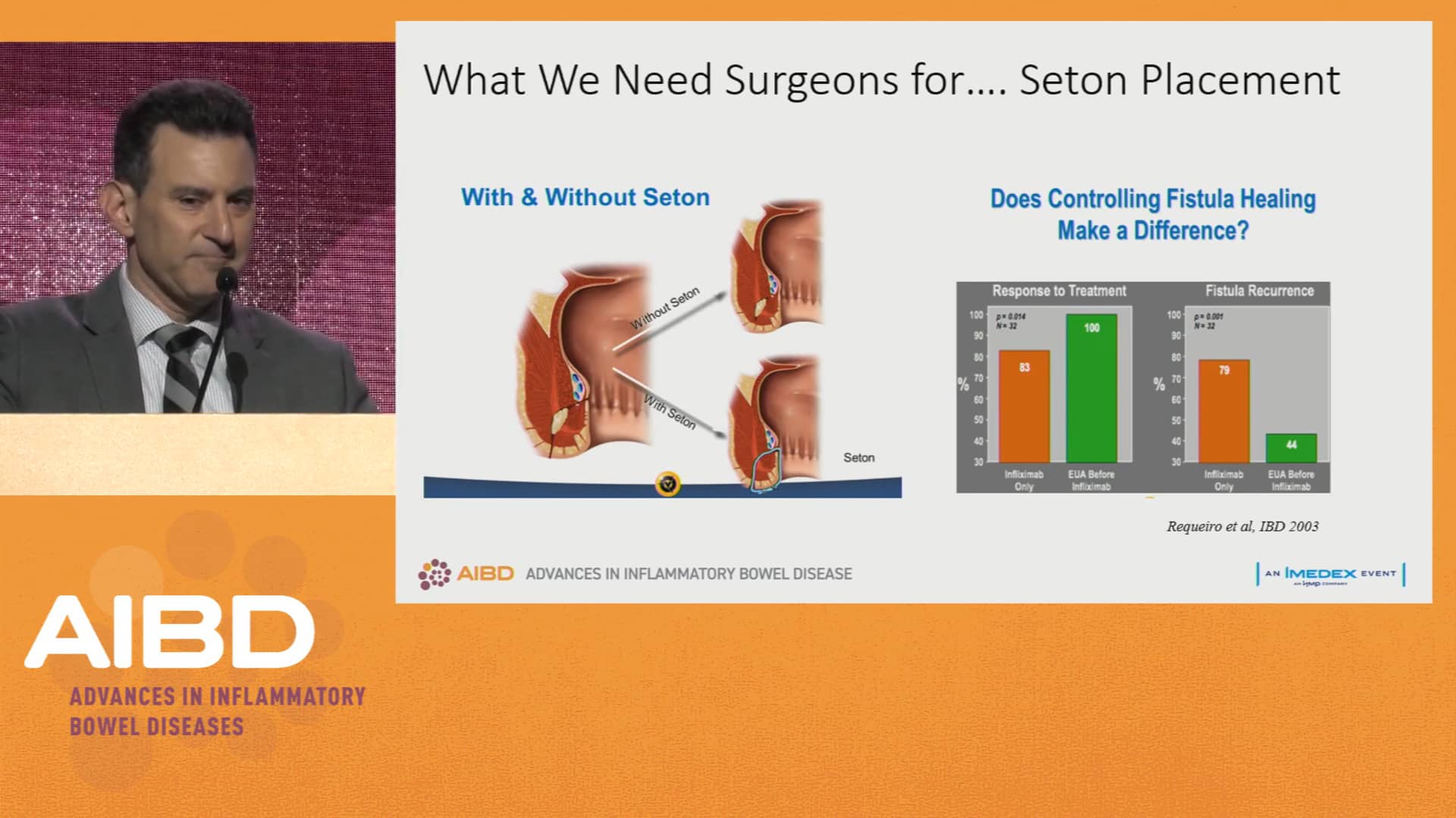 Debate 1: Crohn's disease patient with a vaginal fistula, three months ...